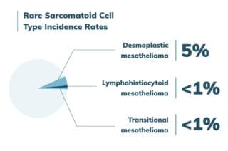 Sarcomatoid Mesothelioma | Prognosis, Treatment & Diagnosis